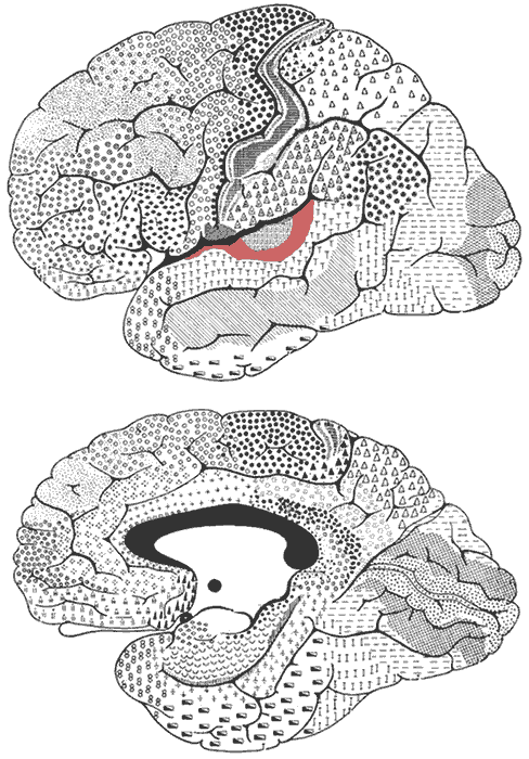 Aire de Brodmann 42 : Cortex auditif primaire